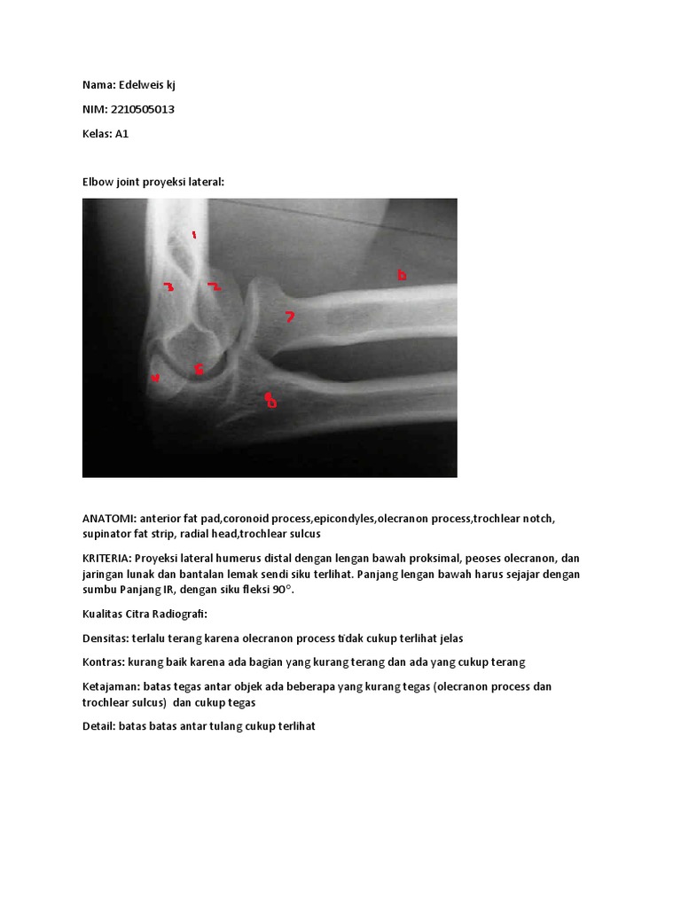 Anatomi Elbow Joint | PDF