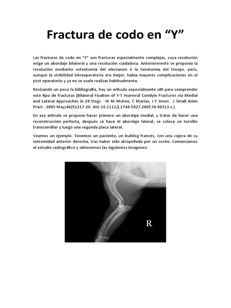 120 - Fractura de Codo en Y | PDF | Codo | Especialidades Medicas