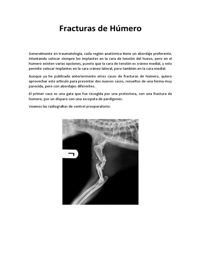 119 - Fracturas de Húmero | PDF | Hueso | Medicina CLINICA