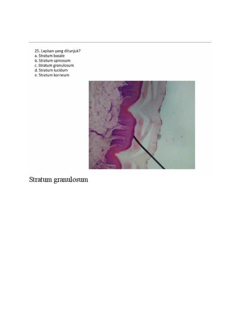 Histo 1 | PDF