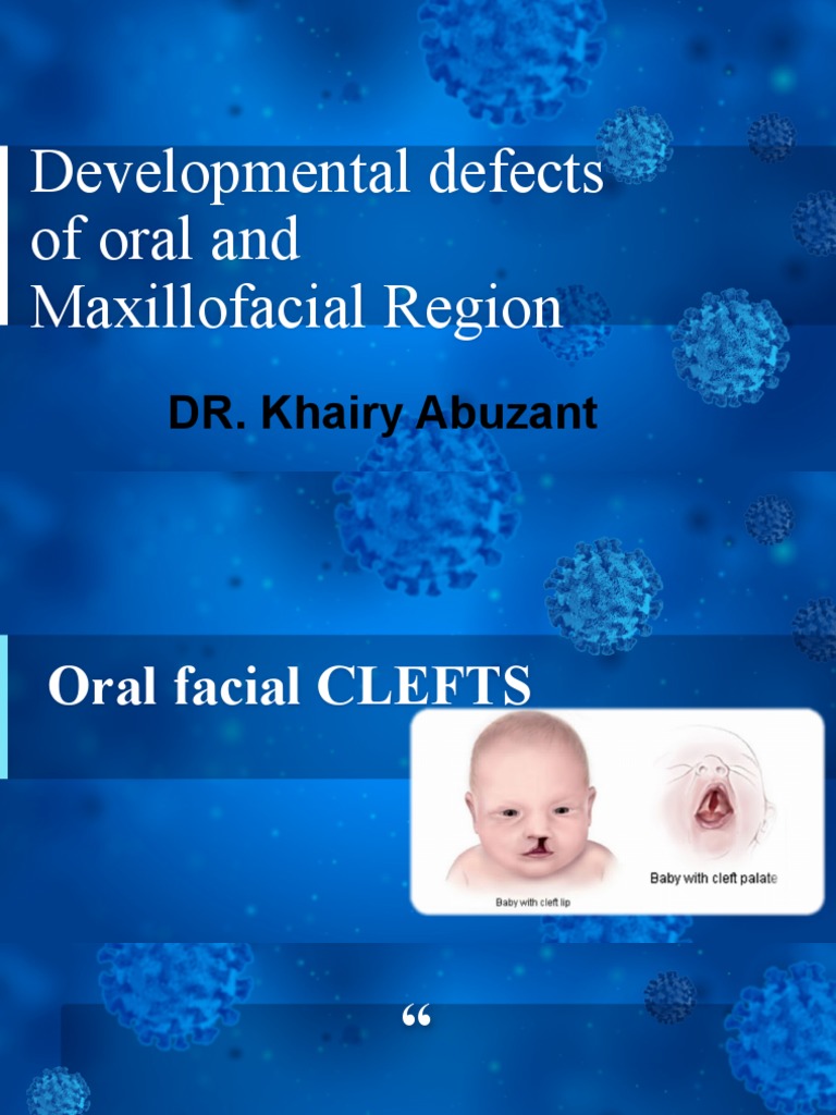 Developmental Defects of Oral and Maxillofacial Region | PDF | Medical ...