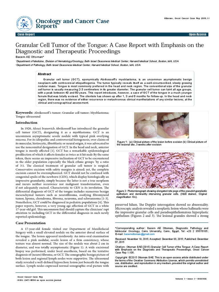 Granular Cell Tumor of The Tongue A Case Report With Emphasis On ...