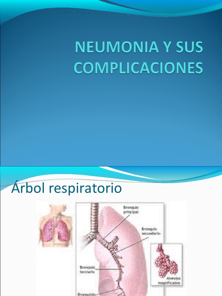 NEUMONIA | PDF | Neumonía | Penicilina