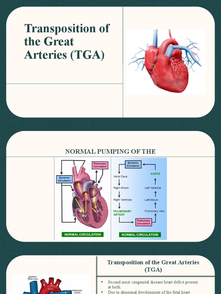 Transposition of The Great Arteries (TGA) | PDF | Cardiology | Medical ...
