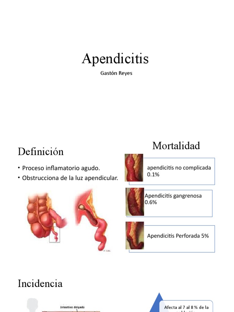 Apendicitis | PDF | Especialidades Medicas | Enfermedades y trastornos