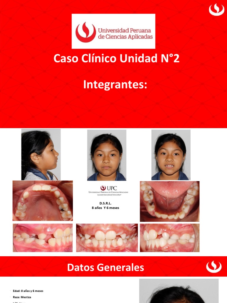 Caso Clínico N°5 | PDF | Boca