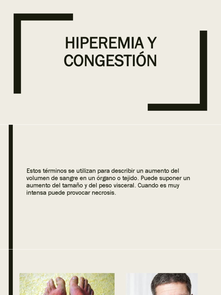 Hiperemia y Congestión: Definición y Tipos | PDF | Vena | Sistema ...