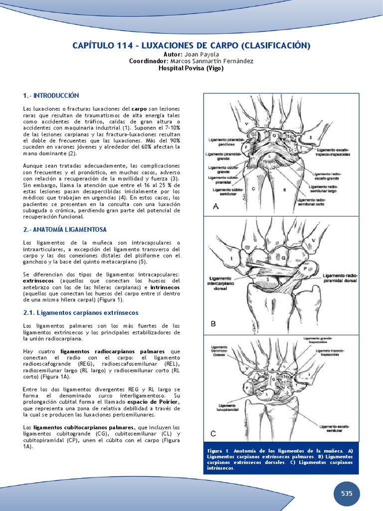 Luxación Carpo | PDF | Mano | Sistema musculoesquelético