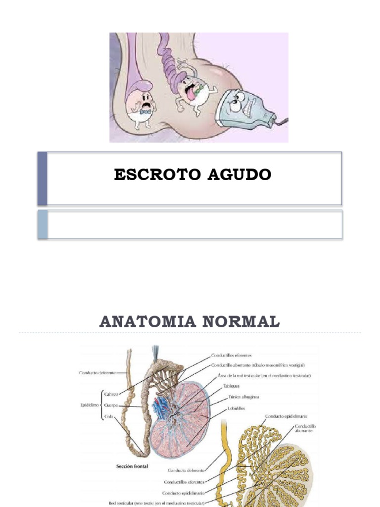 Escroto Agudo | PDF | Testículo | Especialidades Medicas