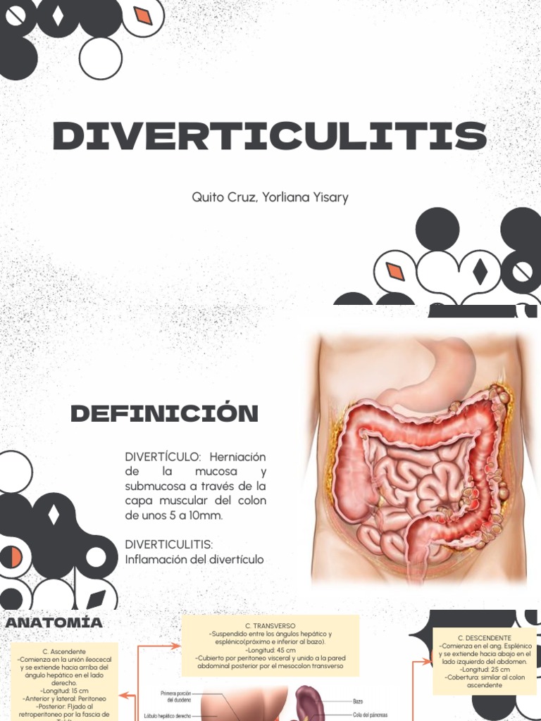 Diverticulitis | PDF | Especialidades Medicas | Enfermedades digestivas