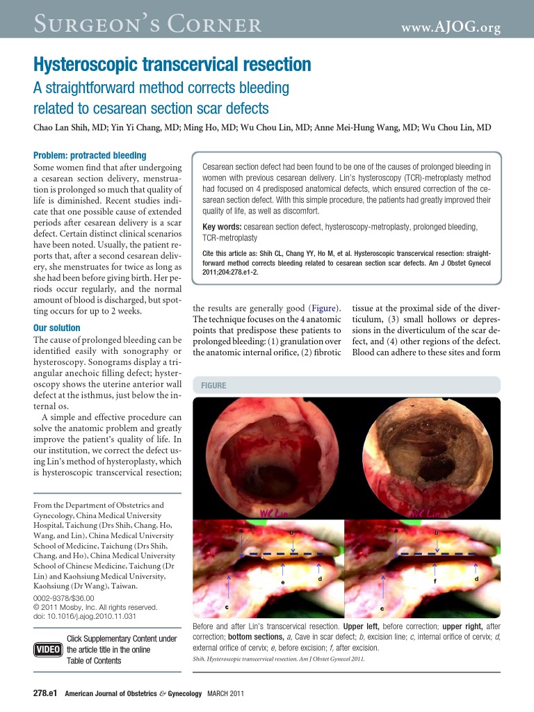 Istmocel | PDF | Women's Health | Human Reproduction
