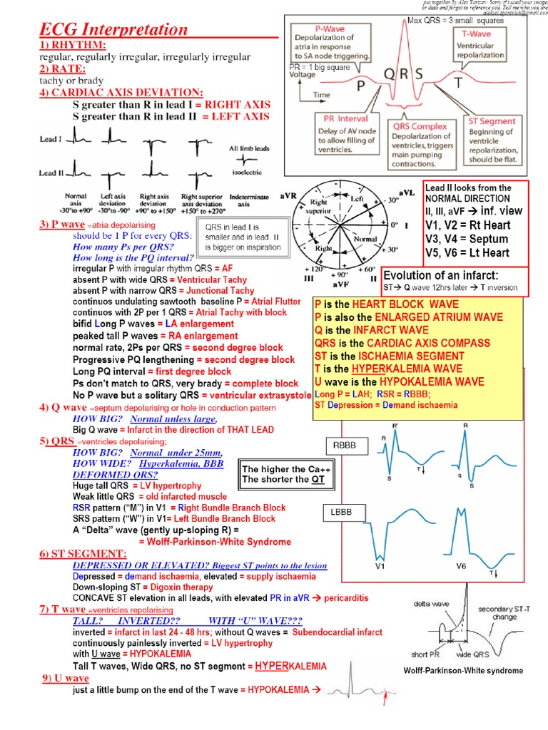ECG Interpretation Cheat Sheet | PDF
