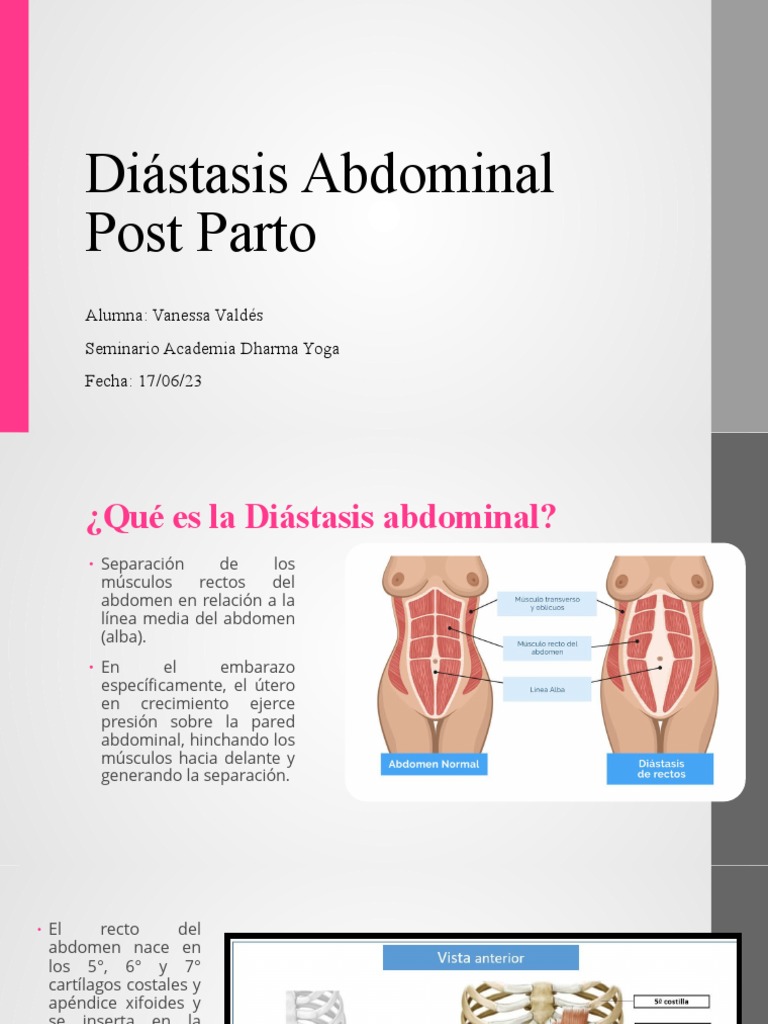 Diástasis Abdominal: Causas y Tratamientos | PDF | Especialidades ...
