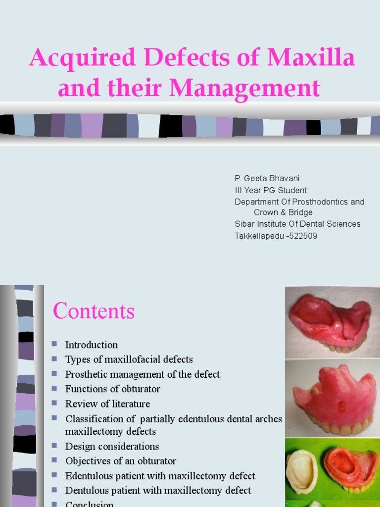 Aramany Classification of Maxillary Defects | PDF | Dentures ...