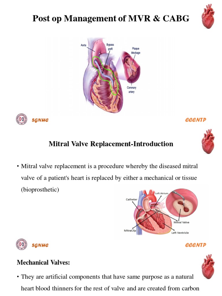 MVR Cabg | Download Free PDF | Coronary Artery Bypass Surgery ...
