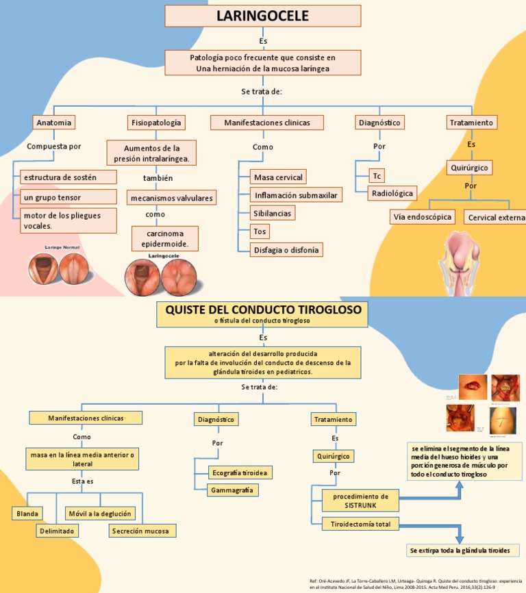 LARINGOCELE | PDF | Tiroides | Cabeza y cuello humanos