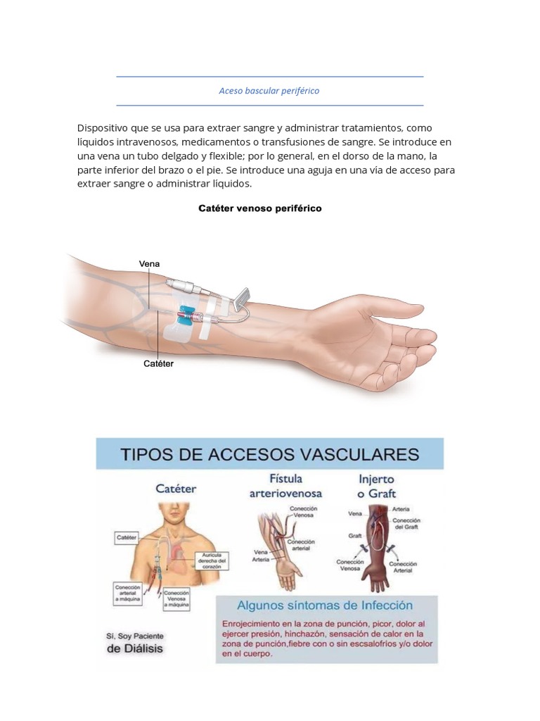 Catéter | PDF | Terapia intravenosa | Embolia