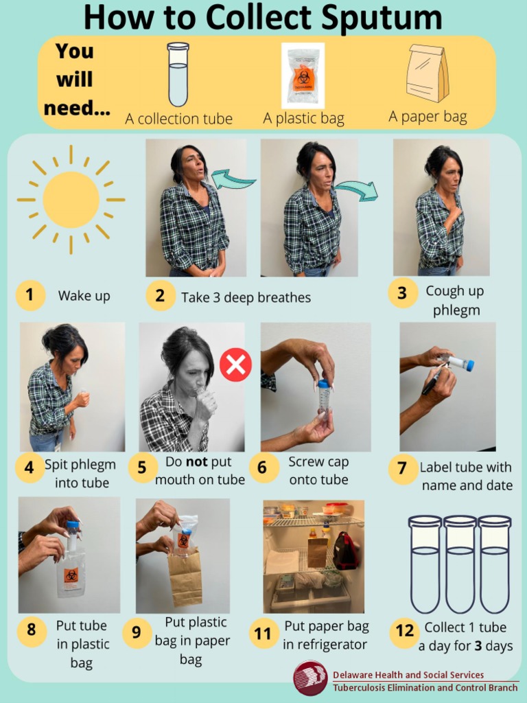 Smith Sputum-Collection-Handout 10052022 | PDF | Tuberculosis | Cough