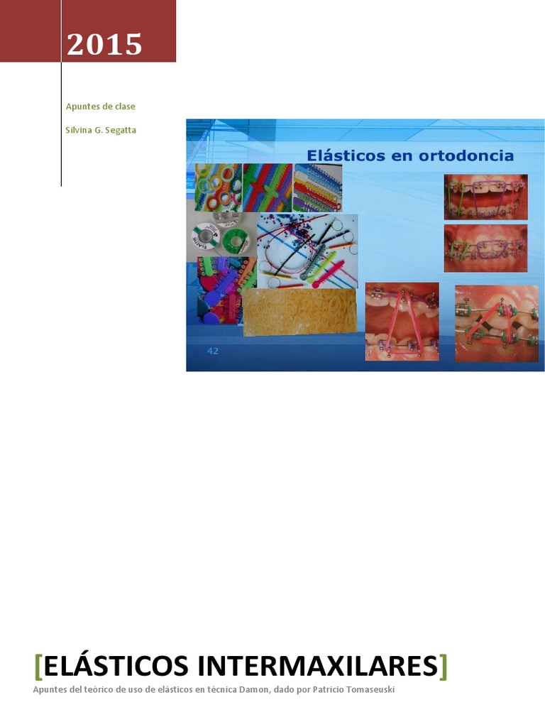 Elasticos Intermaxilares | PDF