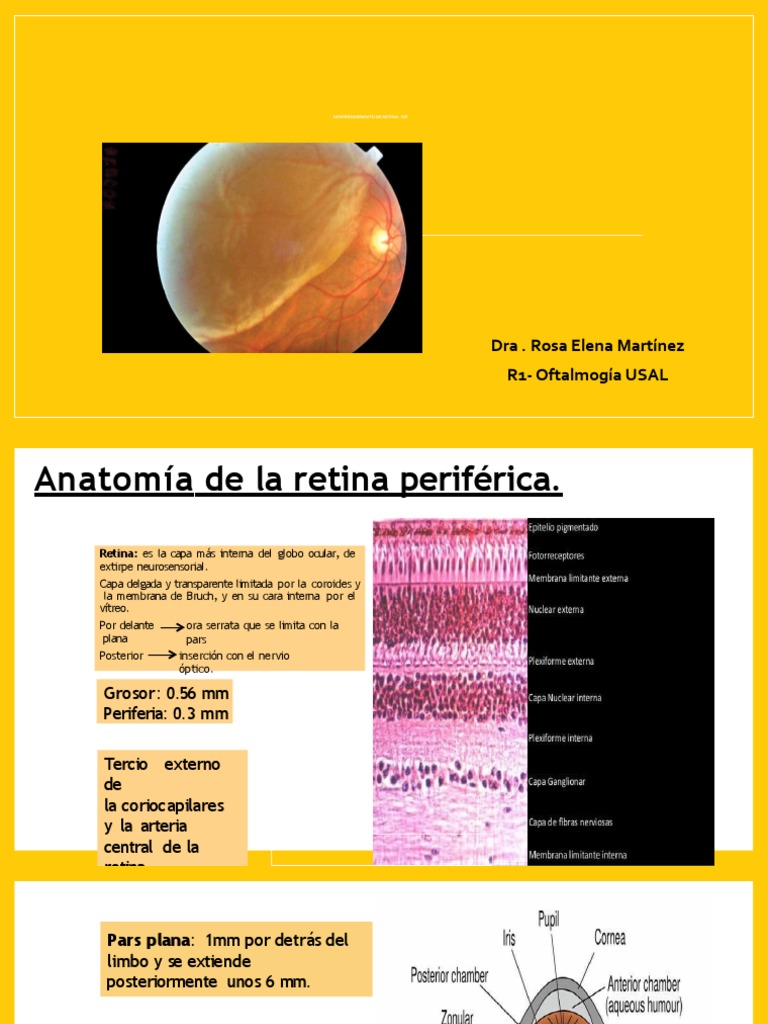 Desprendimiento de Retina | PDF | Retina | Ojo humano