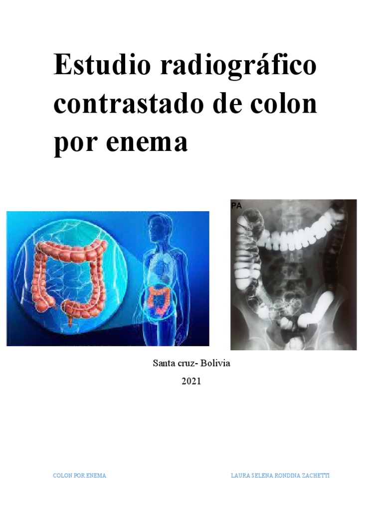 Estudio Radiográfico de Colon por Enema | PDF | Sistema digestivo ...