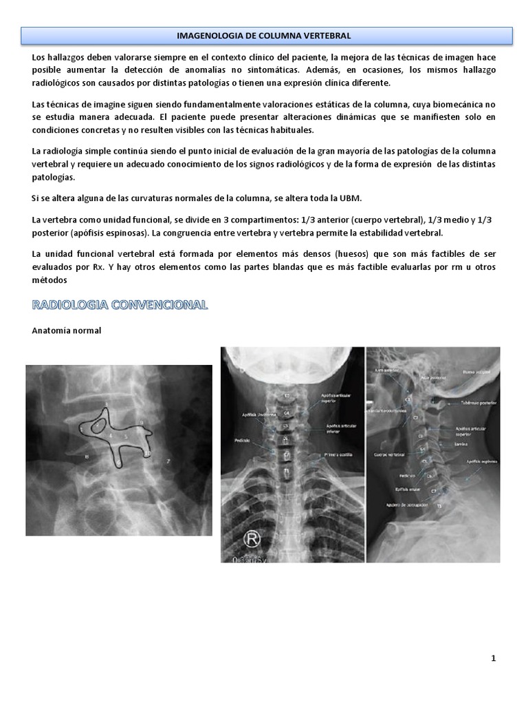 6) Imagenologia de Columna Vertebral | PDF | Vértebra | La columna vertebral