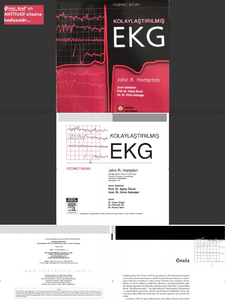Kolaylaştırılmış Ekg | PDF