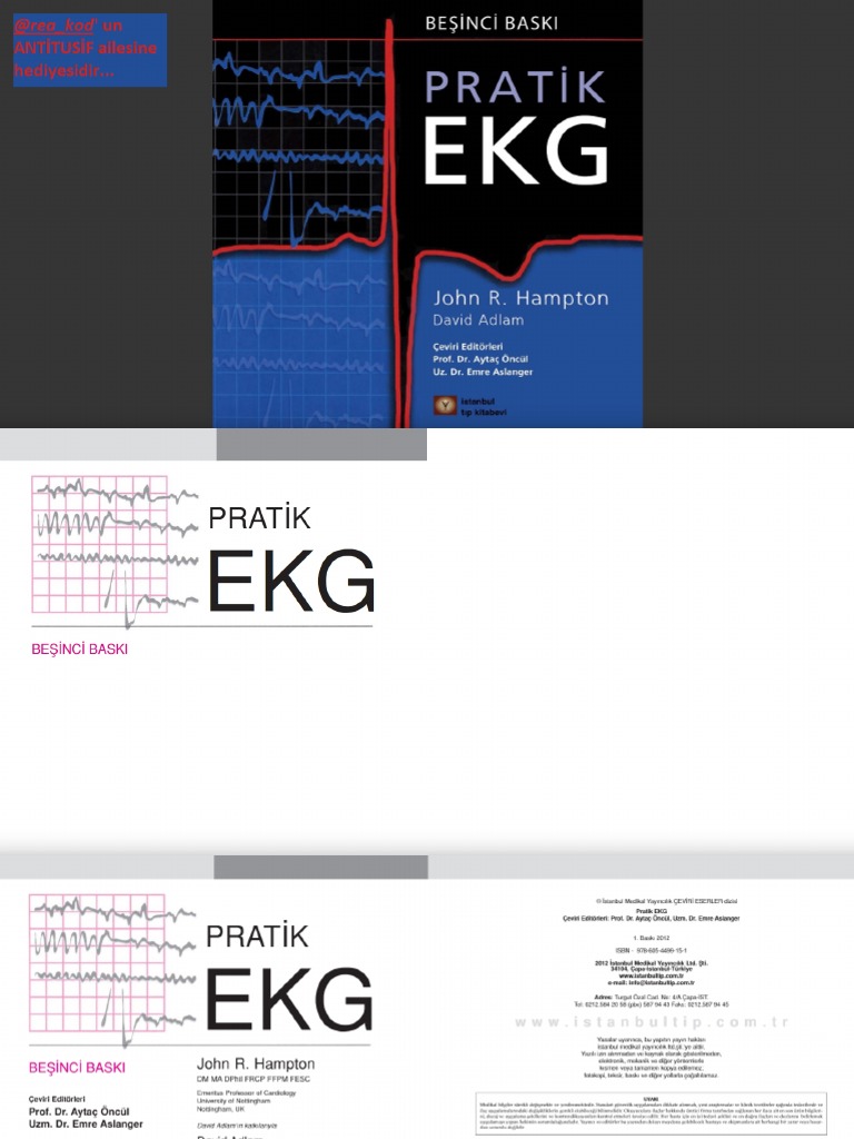 Pratik Ekg | PDF