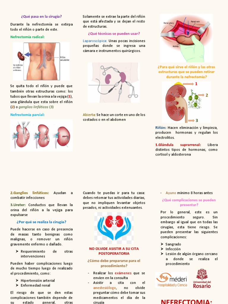 FOLLETO - NEFRECTOMIA-convertido (folleto) | PDF | Riñón | Cirugía