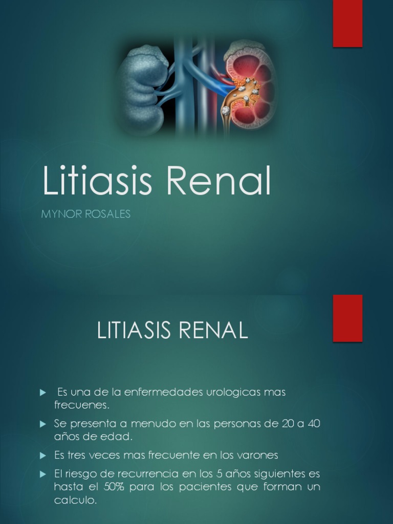 9. Litiasis renal | PDF | Especialidades Medicas | Medicina CLINICA