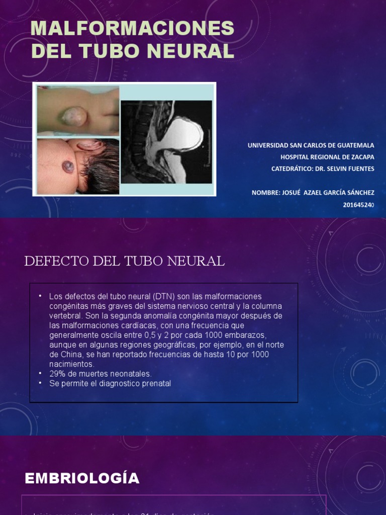 Malformaciones Del Tubo Neural | PDF | Sistema nervioso | Medicina CLINICA