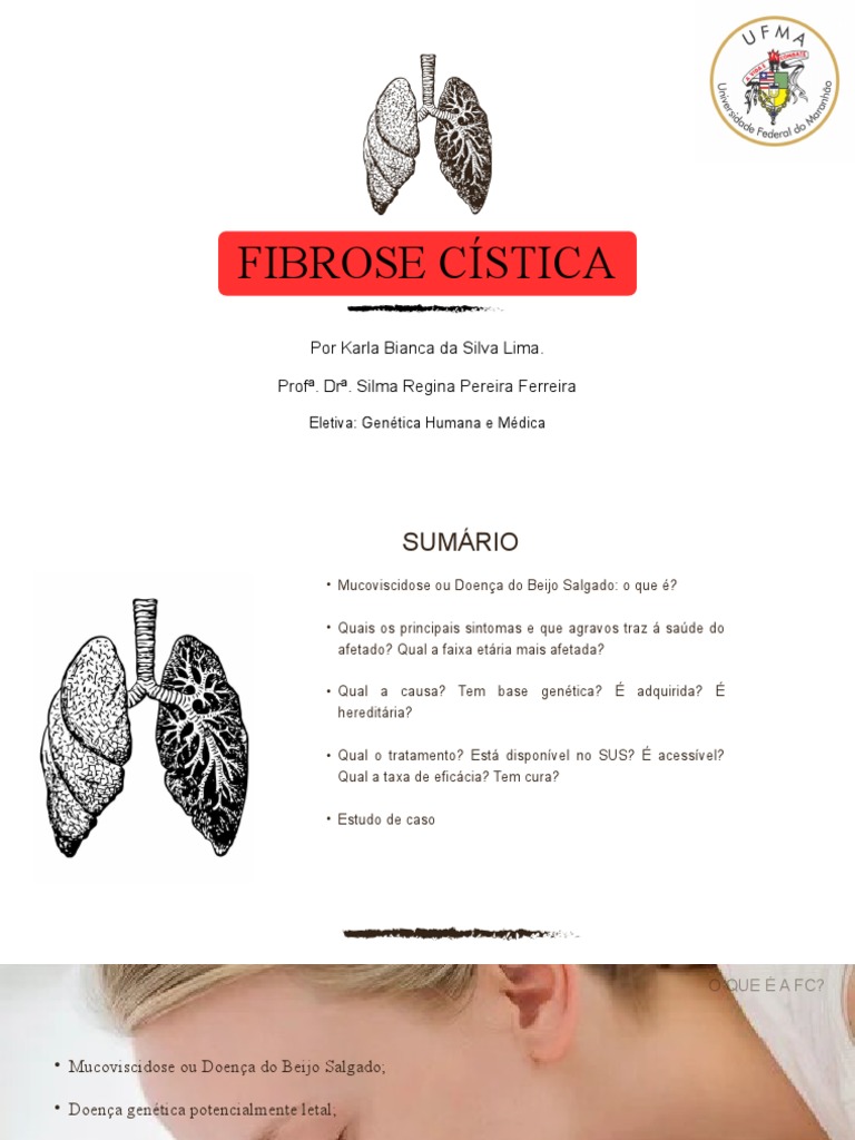 Fibrose Cística | PDF | Epidemiologia | Causas de morte