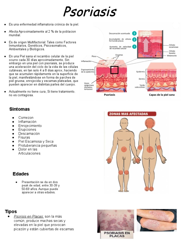 Psoriasis | PDF | Psoriasis | Piel