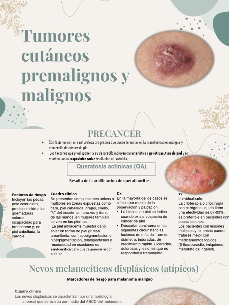 Tumores Cutaneos Malignos | PDF | Cáncer | Melanoma Tumores Cutaneos Malignos | PDF | Cáncer | Melanoma