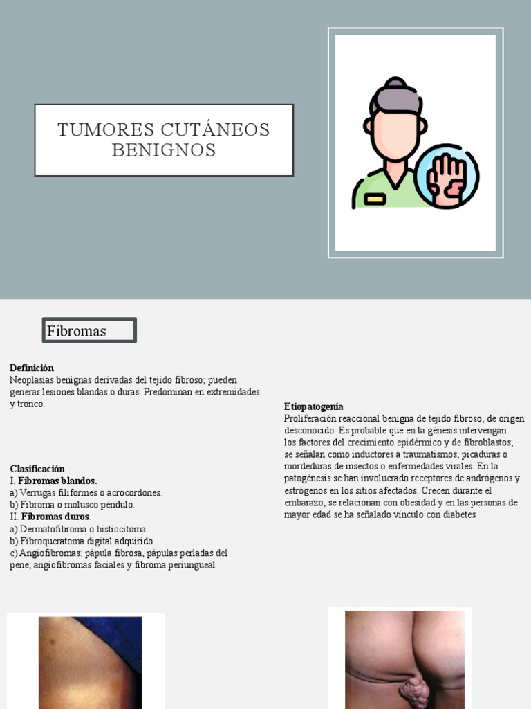Tumores cutáneos benignos | PDF | Cáncer | Neoplasias