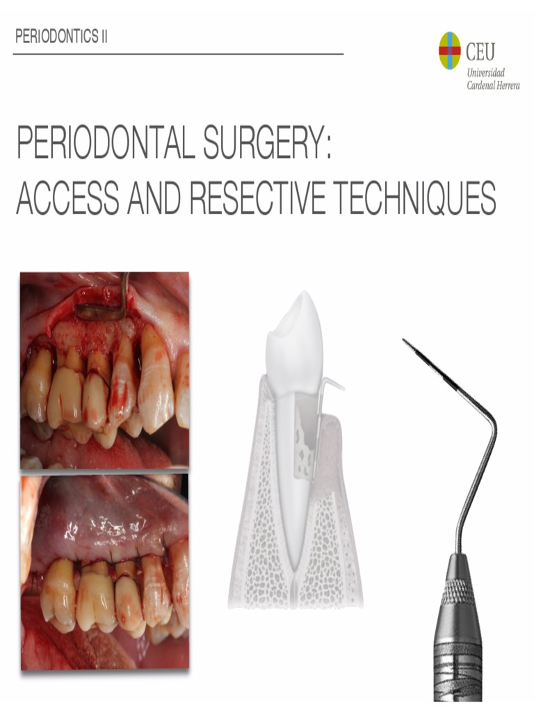 Periodontal Surgery | PDF | Periodontology | Surgery