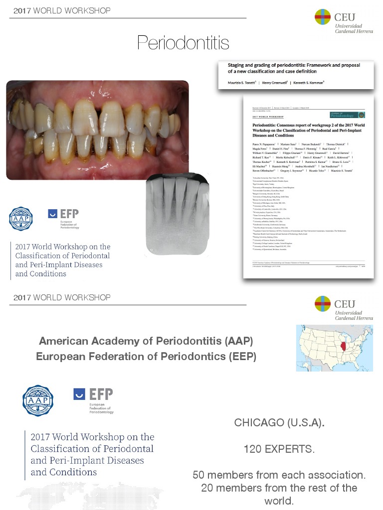 2017 Periodontitis Classification Workshop | PDF | Periodontology ...