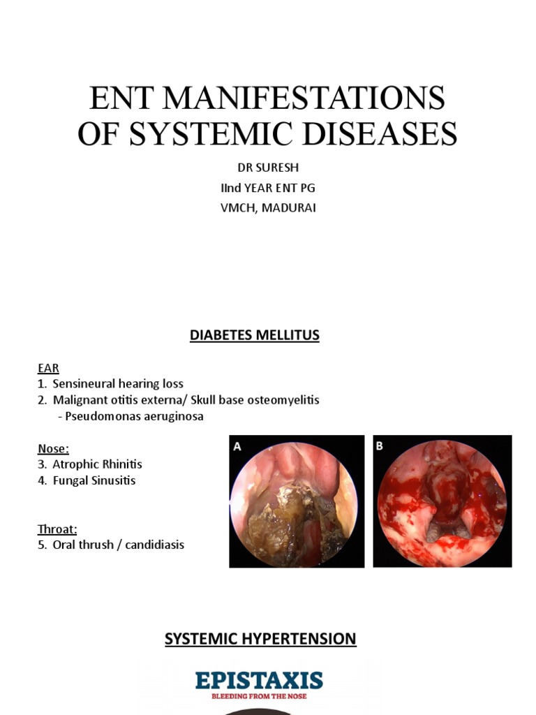 Ent Manifestations of Systemic Diseases | PDF
