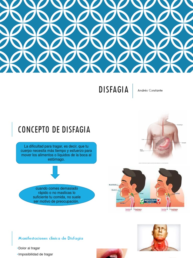 DISFAGIA ANDRES Diapositivas | PDF | Endoscopia | Esófago