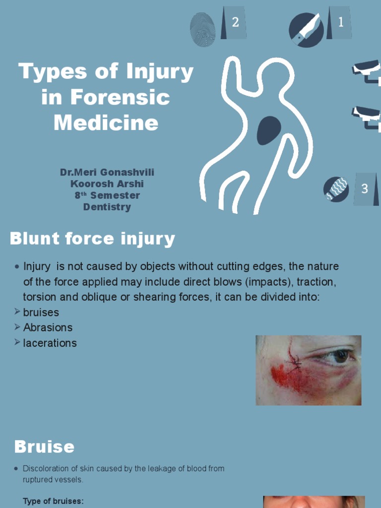 Truama | PDF | Injury | Clinical Medicine