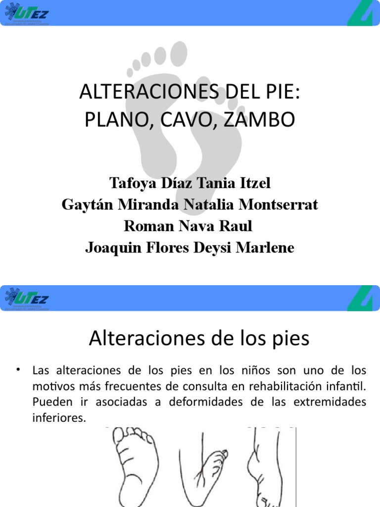Alteraciones del Pie: Plano, Cavo y Zambo | PDF | Pie | Anatomía del ...