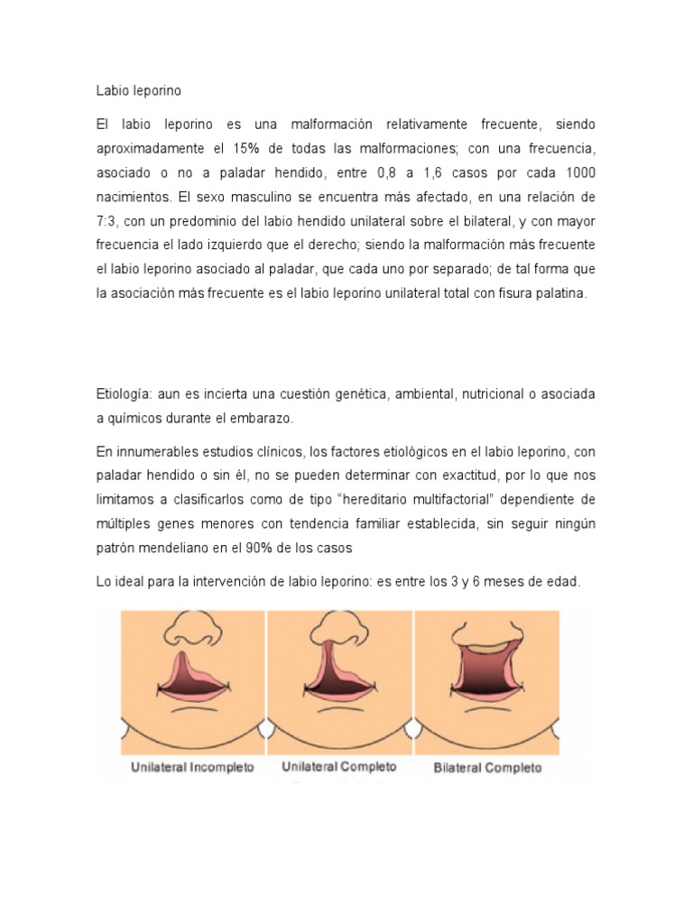 Fisura Labial Bilateral y Labio Leporino | PDF | Anatomía