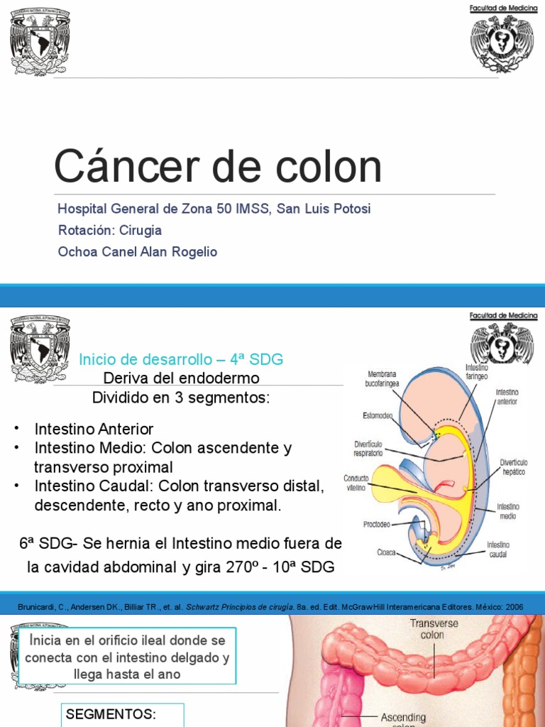 Ca de Colon Ochoa Alan | PDF | Intestino grueso | Gastroenterología