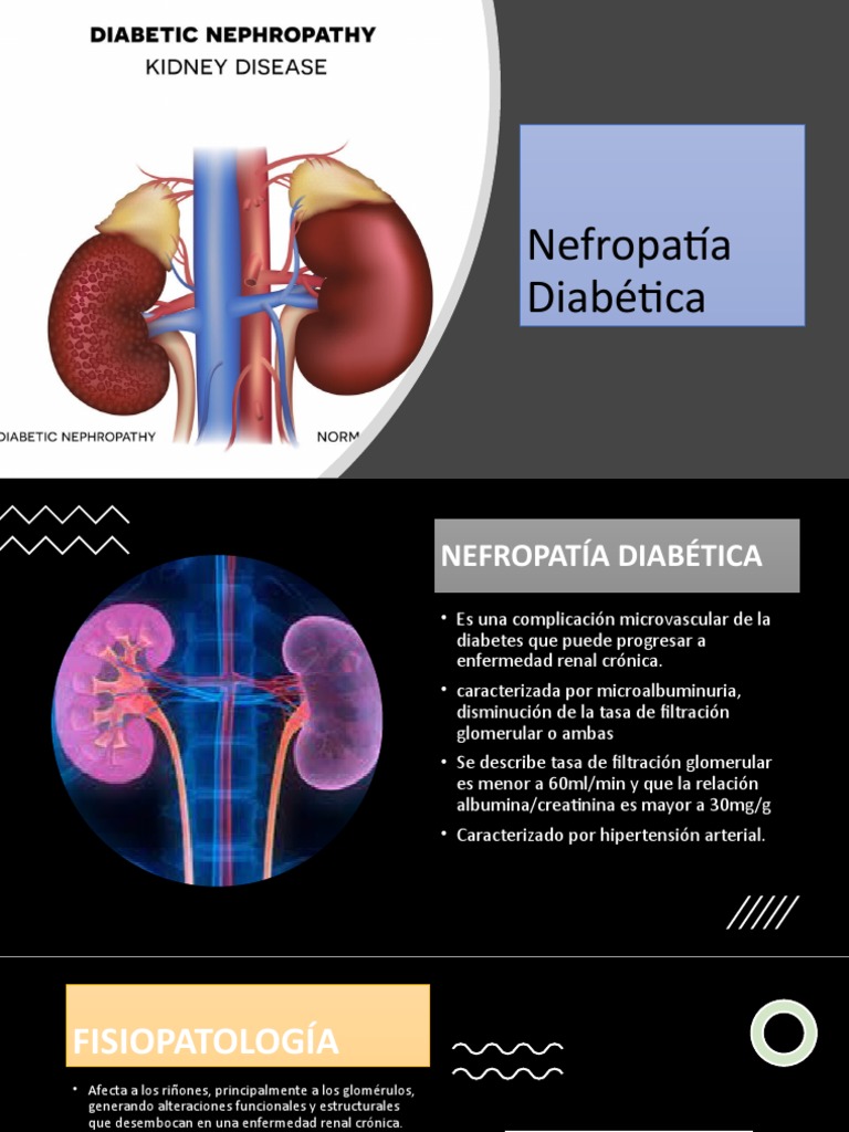 Nefropatía Diabética: Etapas y Tratamiento | PDF | Diabetes ...