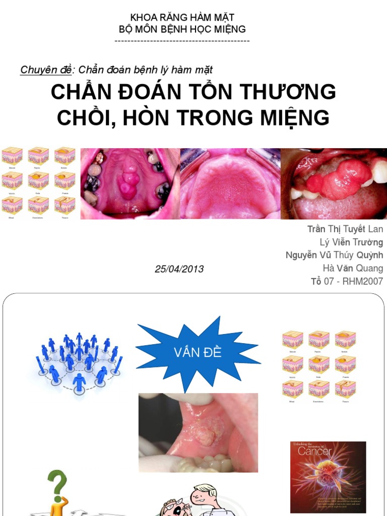 Ton Thuong Choi Hon | PDF