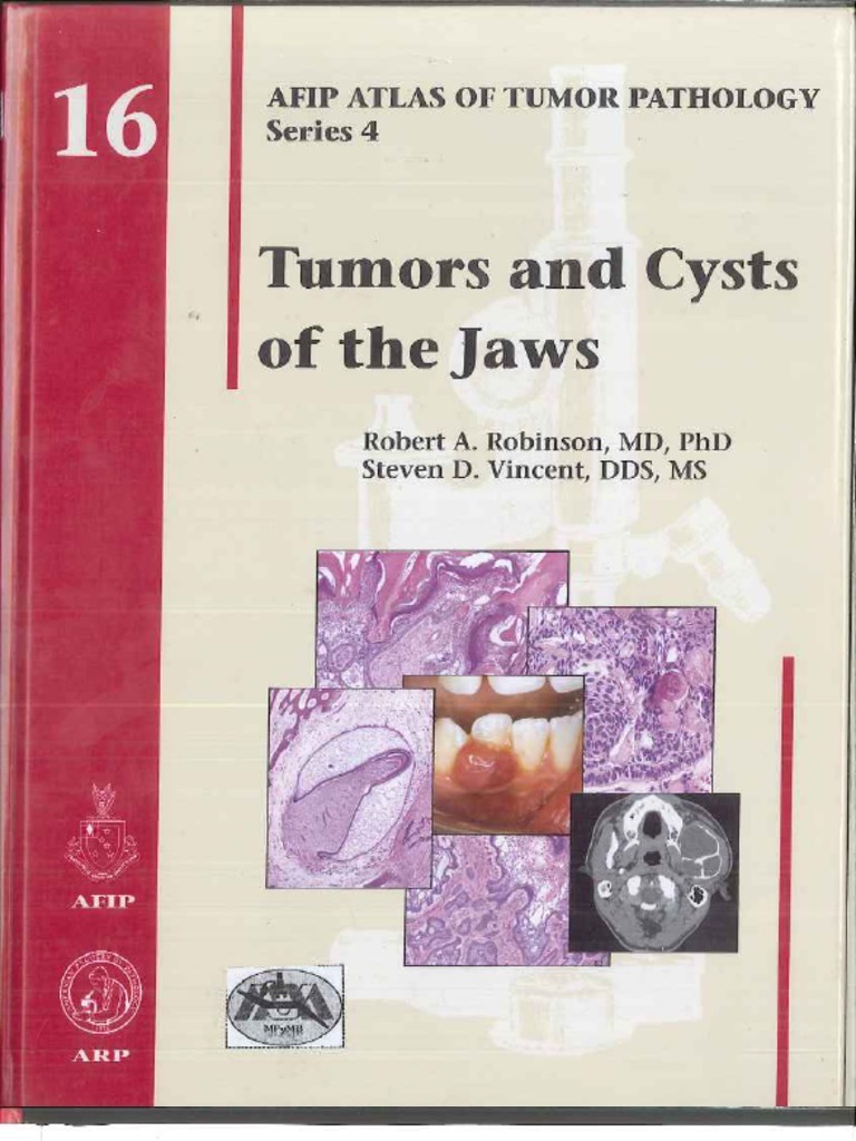 AFIP ATLAS Tumors and Cysts of The Jaws | PDF