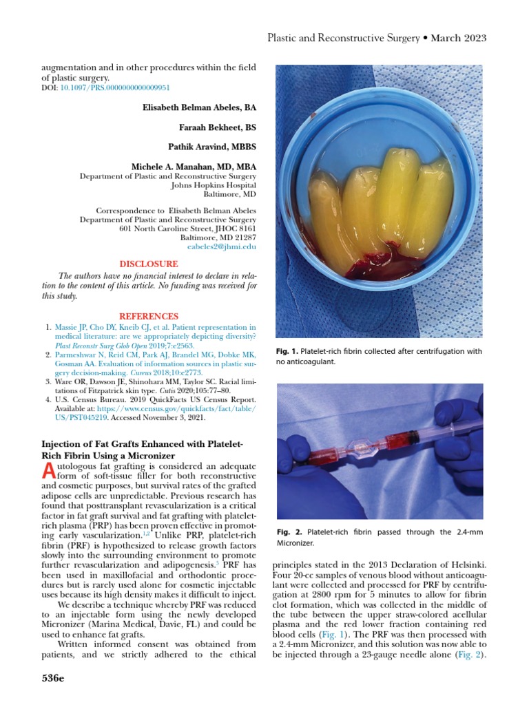 Injection of Fat Grafts Enhanced With Platelet-Rich Fibrin Using A ...