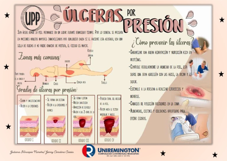 Infografia Ulceras Por Presion | PDF