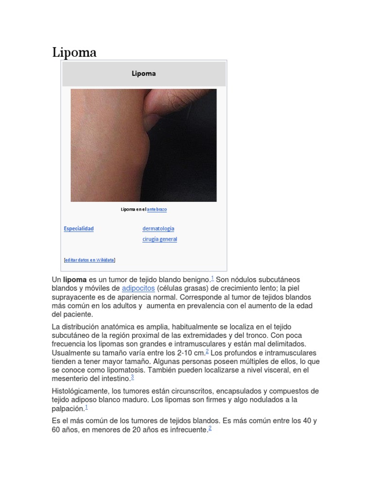 Lipoma | PDF | Neoplasias | Epidemiología