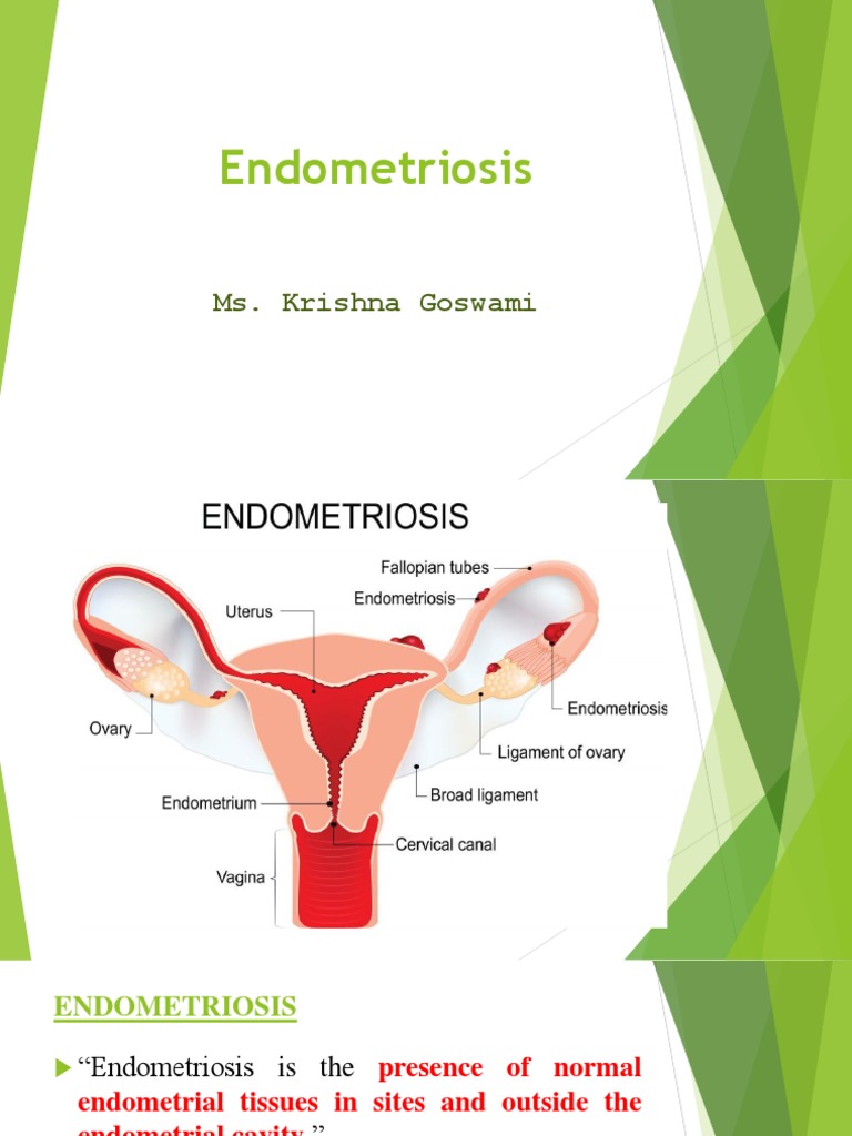 Endo Metros Is Download Free Pdf Menstrual Cycle Menstruation